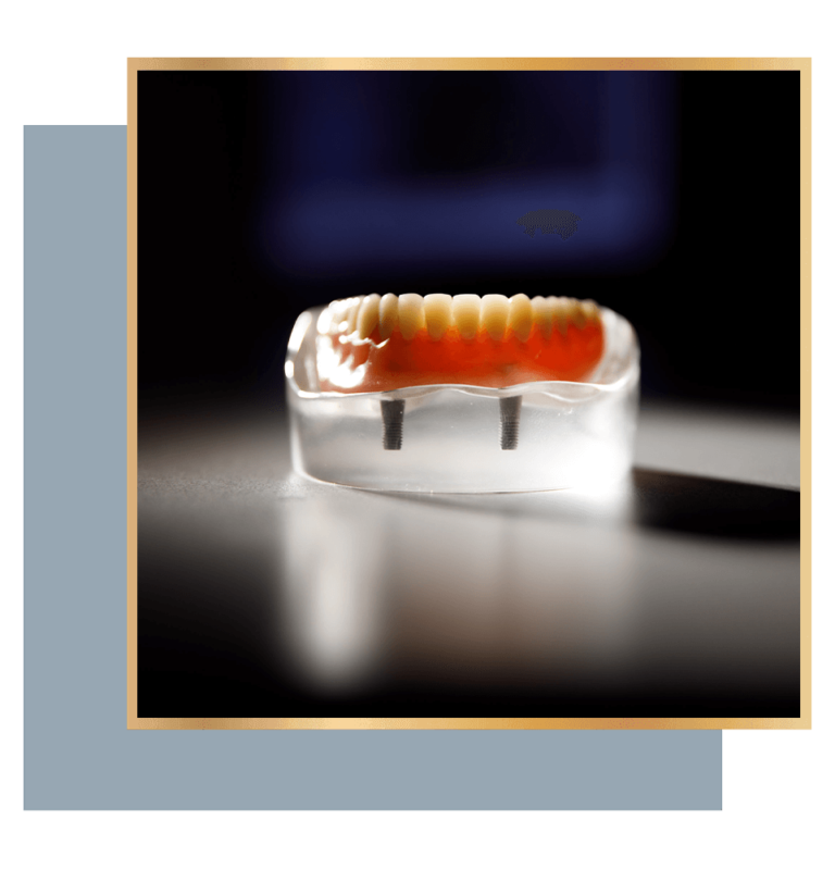 Zirkolith® Dental Implants - Periodontics & Dental Implants